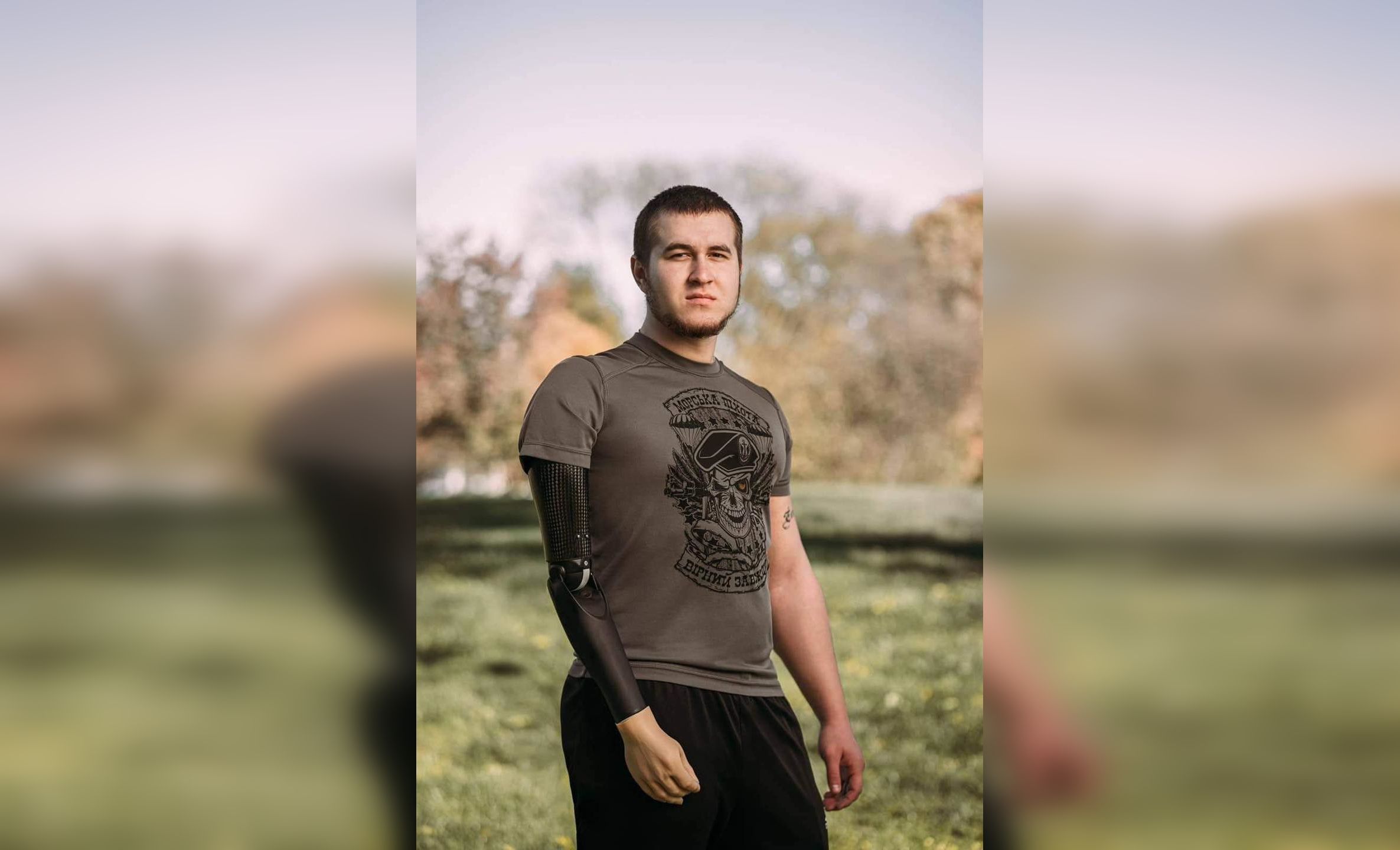 «У полоні відрізали руку 19 річний захисник Маріуполя освоює біонічний протез 20 хвилин Вінниця